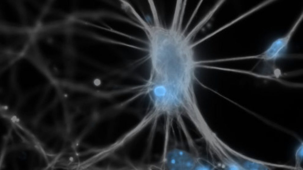 Exploring the Flawlessness of Nature – The Marvel of Neurons | The ...